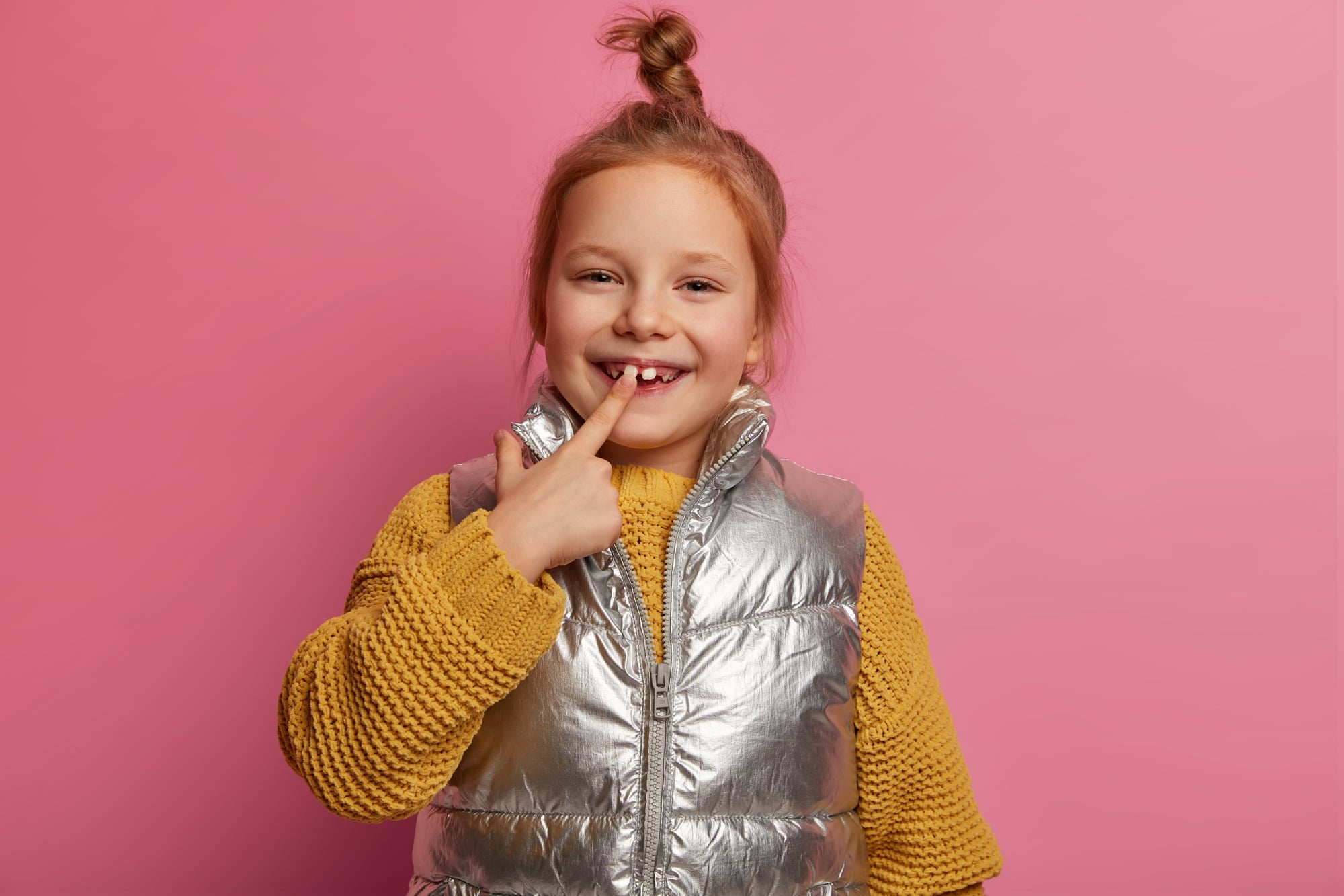 Braces: Before and After Buck Teeth